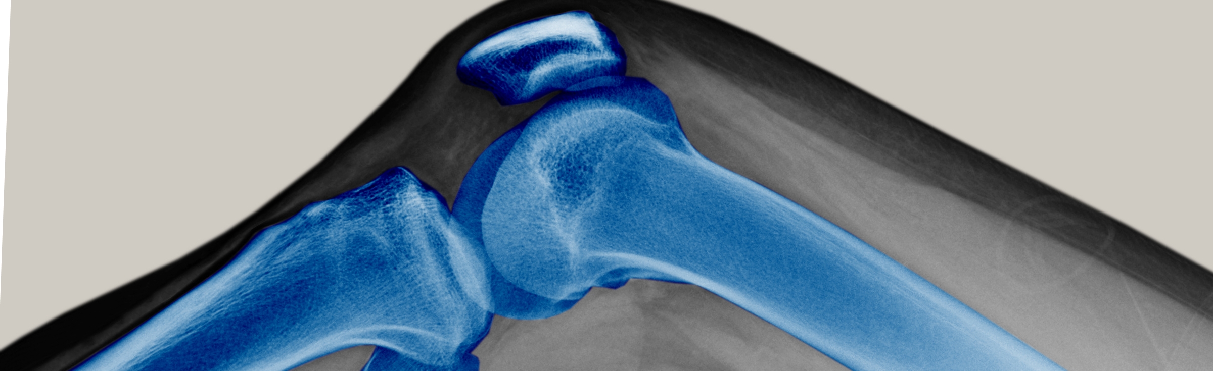 Radiology - Grosvenor Orthopaedic Partners